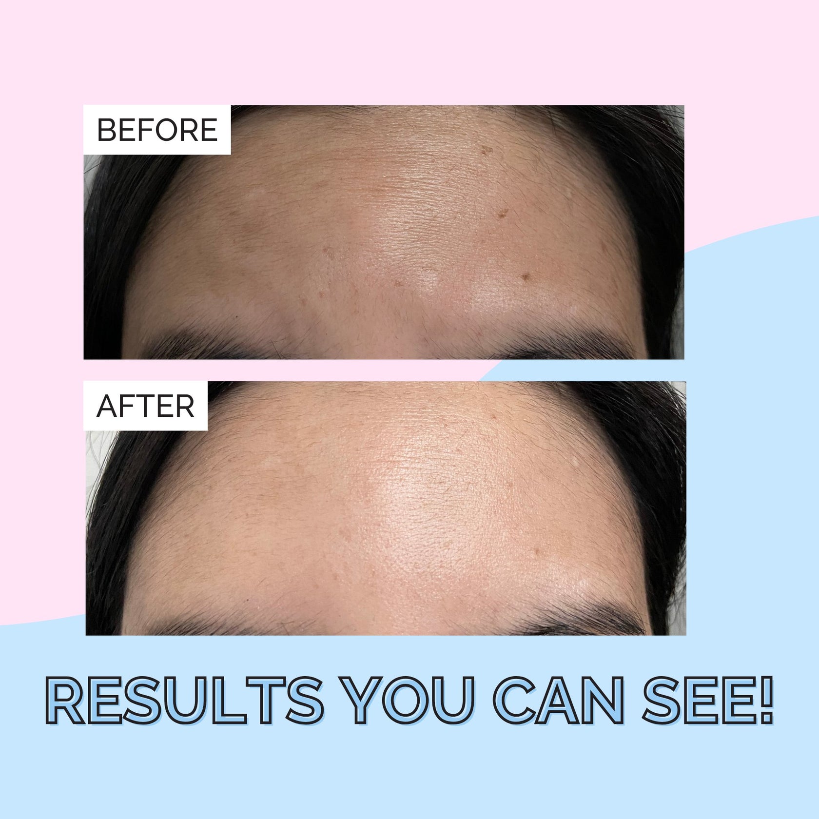 Snail Mucin Serum | Elizabeth Mott